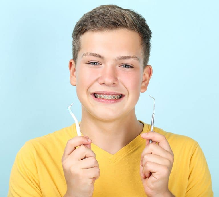 Two-Phase Braces | Stoney Creek and Hamilton Orthodontics